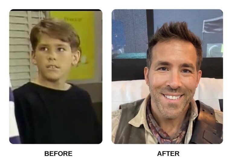 Ryan Reynolds Teeth Before and After: What Happened in His ...