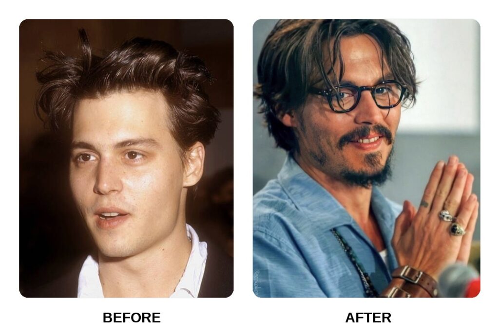 Johnny Depp Teeth Before and After: What Happened in His Transformation ...