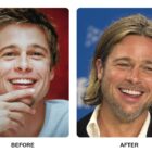 Chris Brown Teeth Before and After: What Happened in His Transformation ...