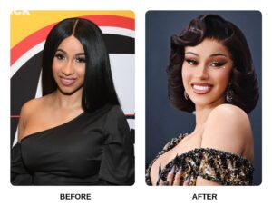 Cardi B Teeth Before and After: What Happened in Her Transformation ...