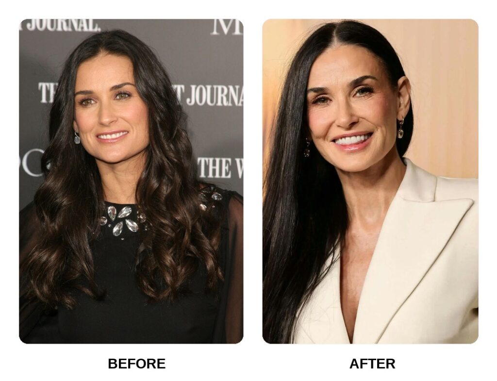 Demi Moore Teeth Before and After: What Happened in Her Transformation ...