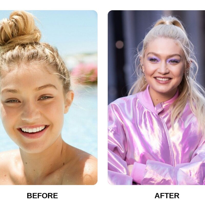 Britney Spears Teeth Before and After: What Happened in Her ...