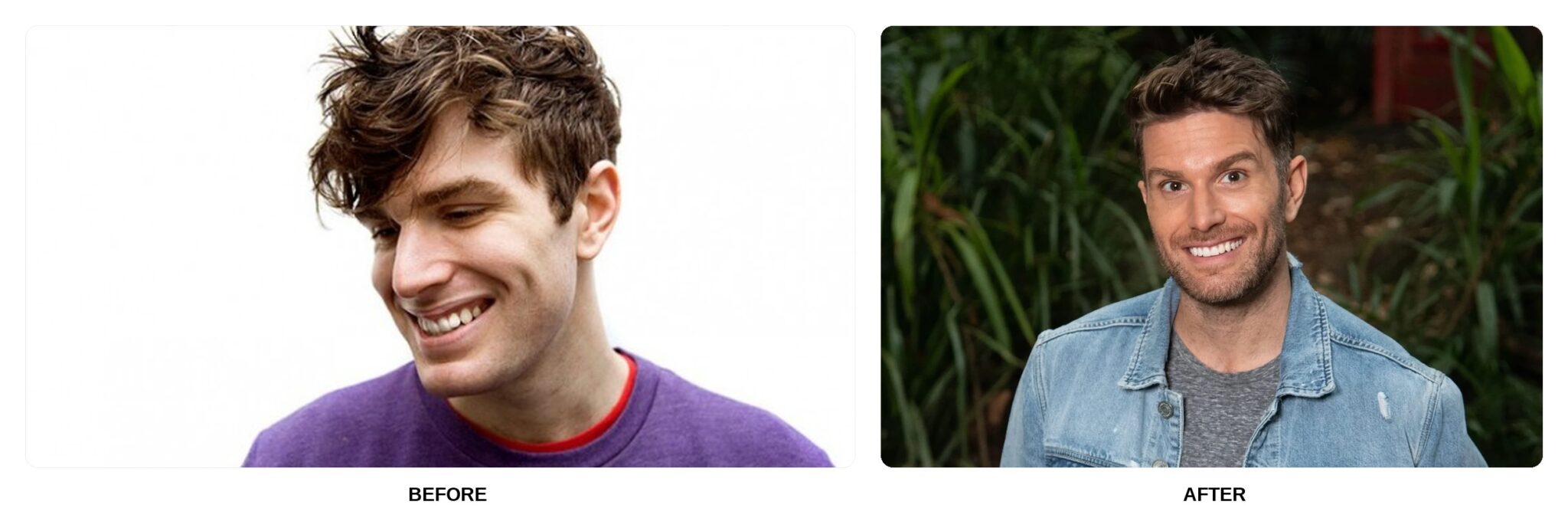 Post Malone Teeth Before and After: What Happened in His Transformation ...