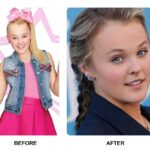 Ronaldinho Teeth Before and After: What Happened in His Transformation ...