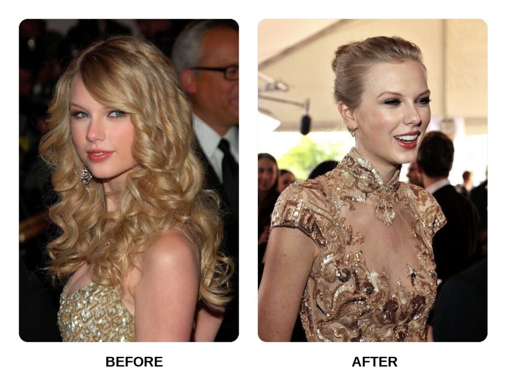 Taylor Swift Teeth Before and After: What Happened in Her ...