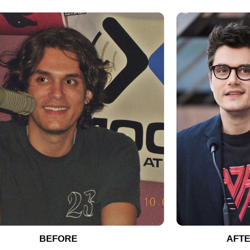 Jim Carrey Teeth Before and After: What Happened in Her Transformation ...