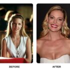 Kate Middleton Teeth Before and After: What Happened in Her ...