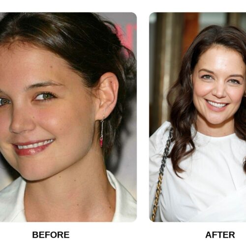 Cardi B Teeth Before and After: What Happened in Her Transformation ...