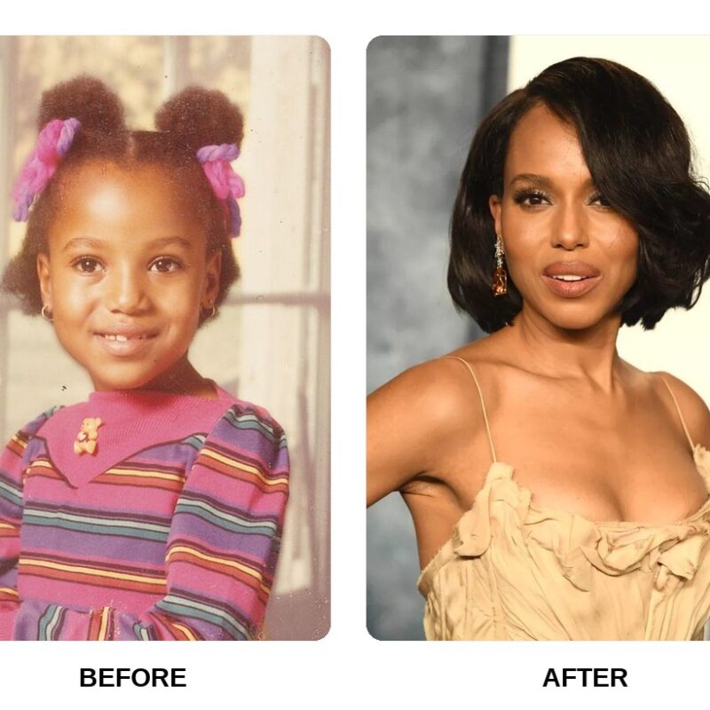 Tom Hardy Teeth Before and After: What Happened in His Transformation ...