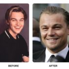 Sierra Ferrell Teeth Before and After: What Happened in Her ...