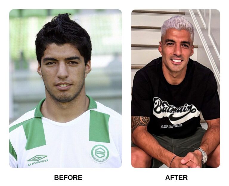 Aaron Judge Teeth Before and After: What Happened in His Transformation ...