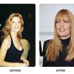 Cardi B Teeth Before and After: What Happened in Her Transformation ...