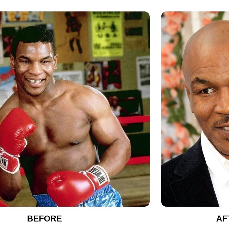 Emily Blunt Teeth Before and After: What Happened in Her Transformation ...