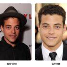 Freddie Freeman Teeth Before and After: What Happened in His ...